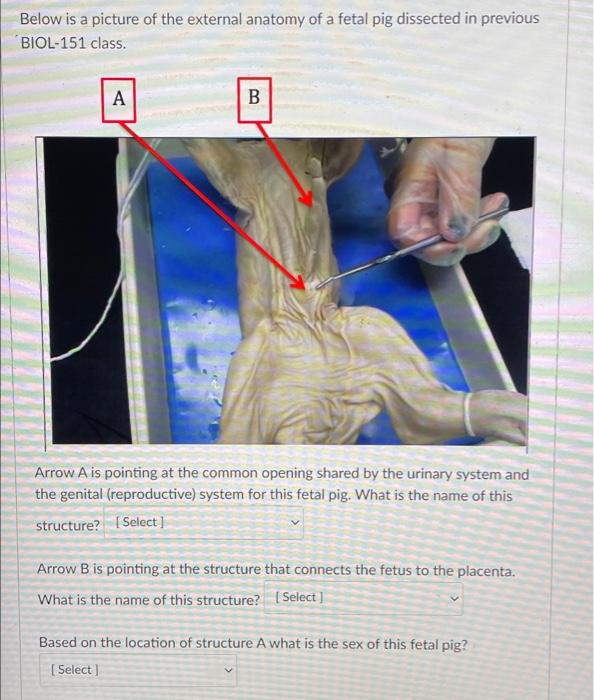 Solved Below is a picture of the external anatomy of a fetal | Chegg.com