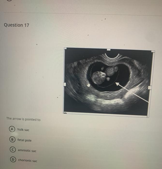 Solved Question 1 LMP means A last day of the last menstrual | Chegg.com