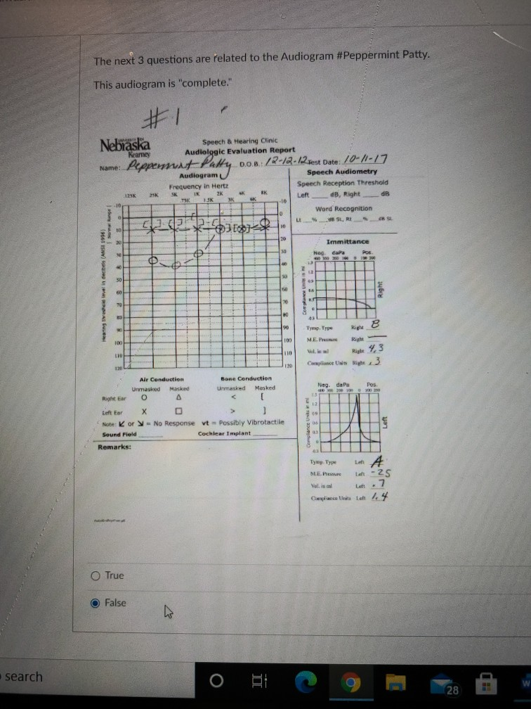 Solved The next 3 questions are related to the Audiogram | Chegg.com