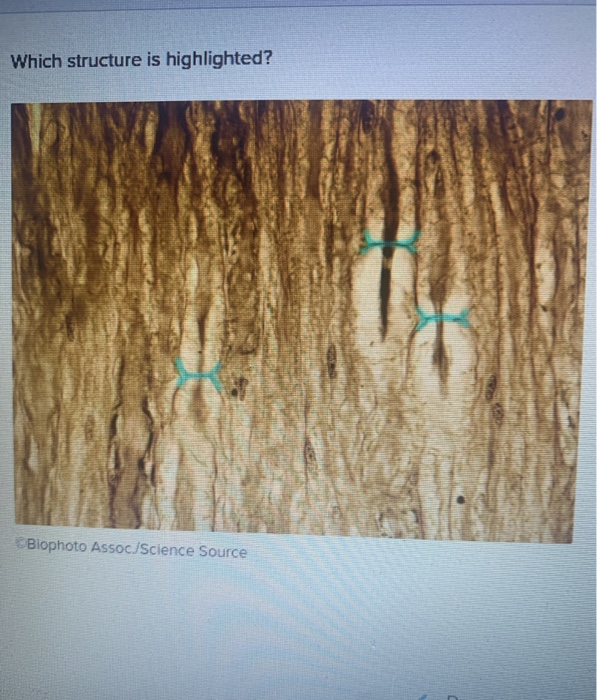 Solved Which structure is highlighted? Biophoto | Chegg.com