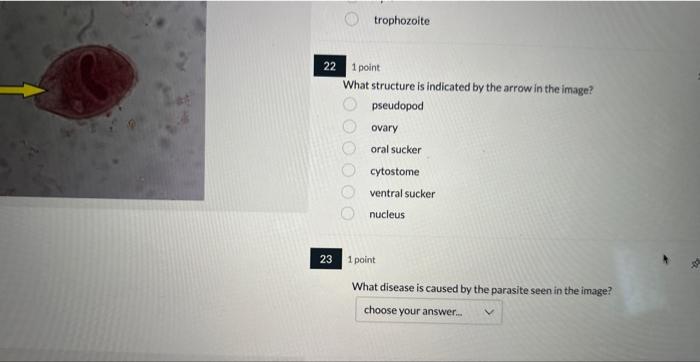 Solved What is the scientific name for the parasite seen in | Chegg.com