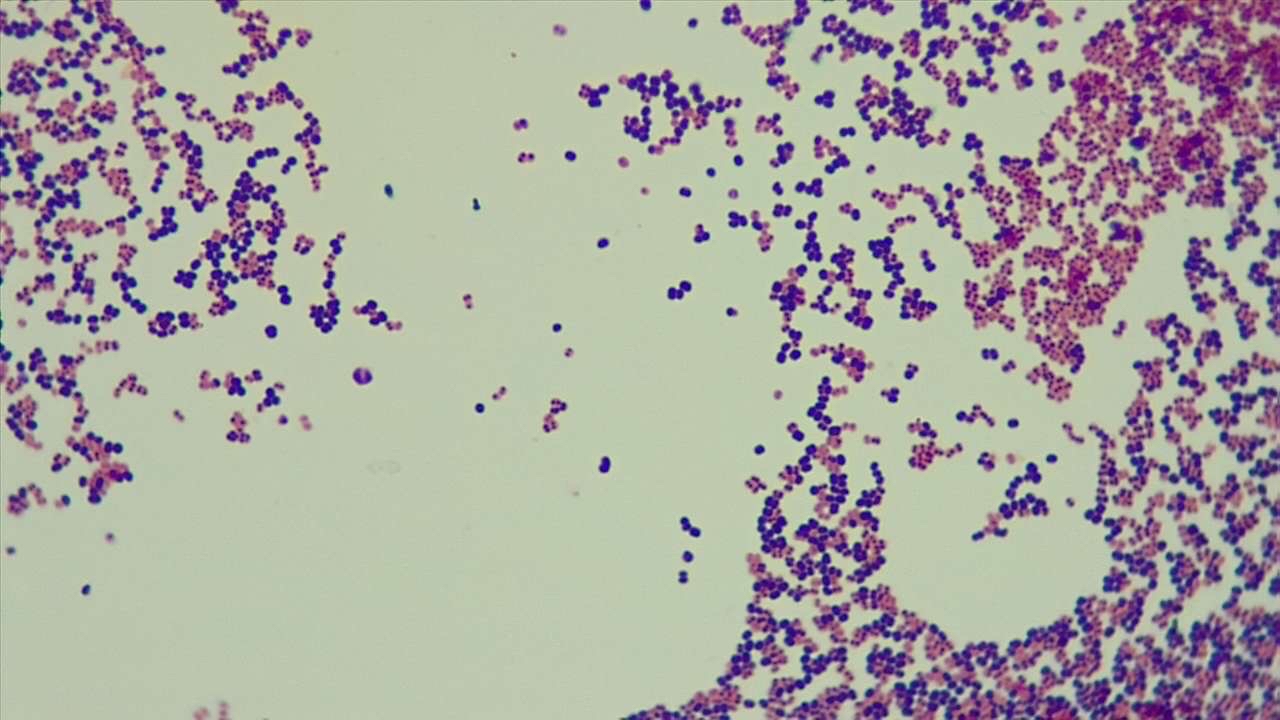 Solved Gram Stain: -Unknown #5C Is the image Gram-Negative | Chegg.com