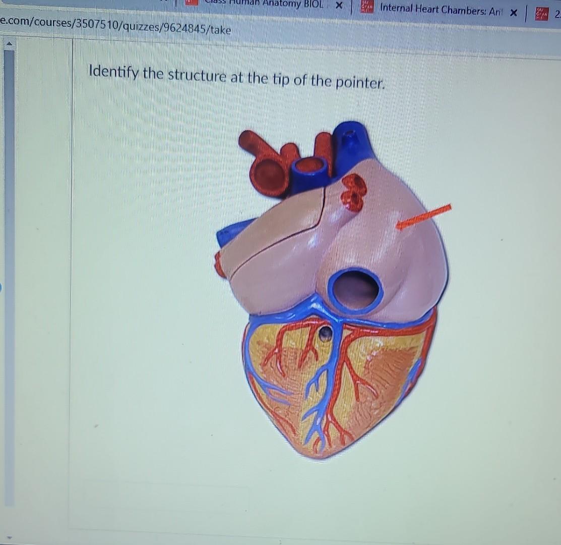 Solved Identify the structure at the tip of the | Chegg.com