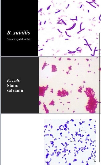 Solved B. subtilis Stain: Crystal violet E. coli: Stain: | Chegg.com