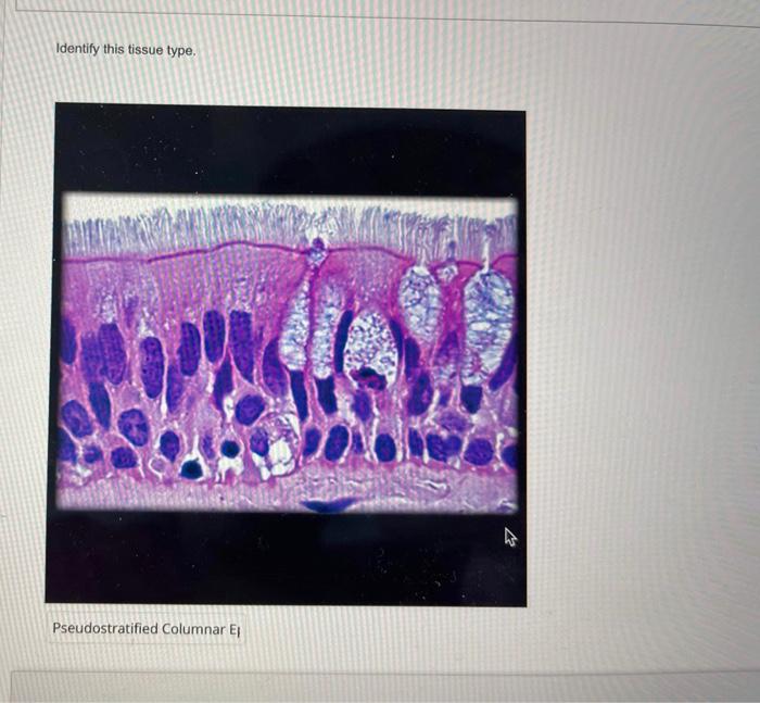 Solved Identify this highlighted tissue type Simple Cuboidal | Chegg.com