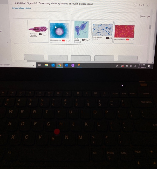 Solved Foundation Figure 3.2: Observing Microorganisms | Chegg.com