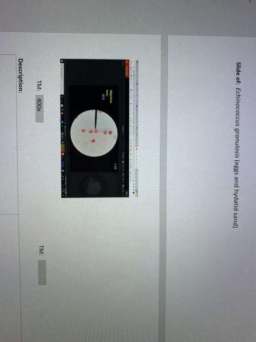 Solved Slide of: Clonorchis sinensis (ova and adult slides) | Chegg.com