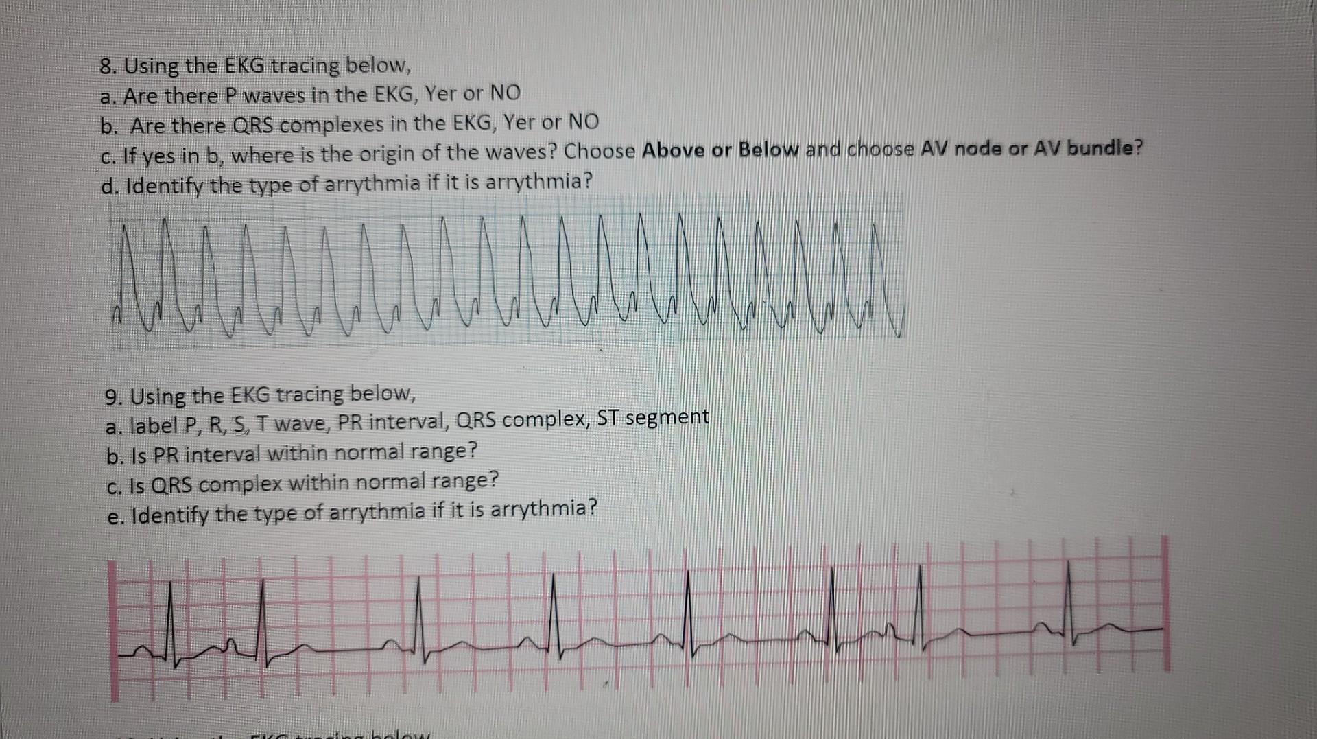 Solved Question 1: Determine the QRS axis for this ECG a. | Chegg.com