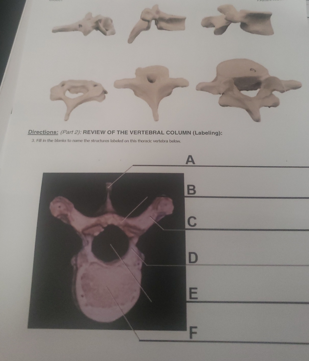 Solved Directions: (Part 2): REVIEW OF THE VERTEBRAL COLUMN | Chegg.com