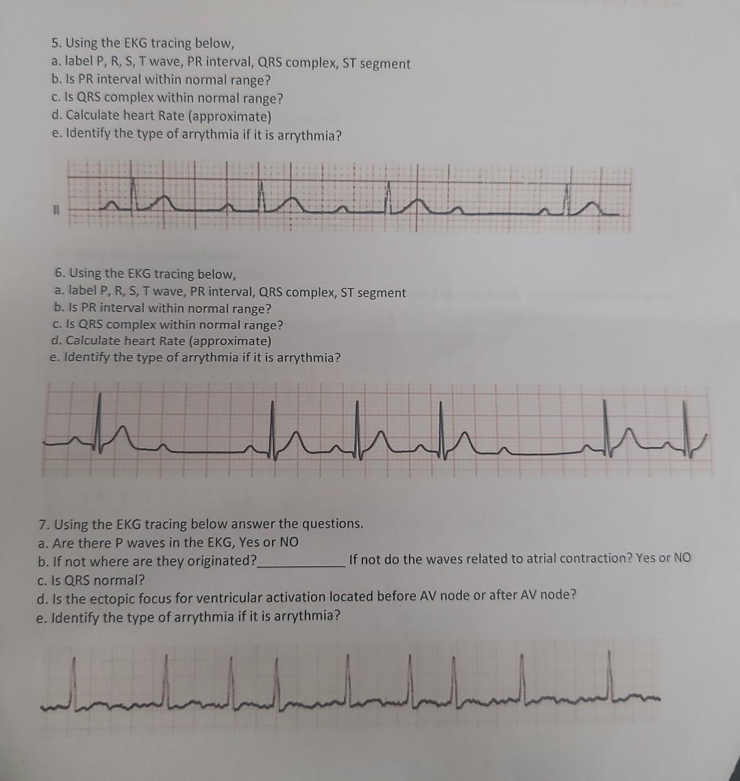 Solved 5. Using the EKG tracing below, a. label P,R,S,T | Chegg.com