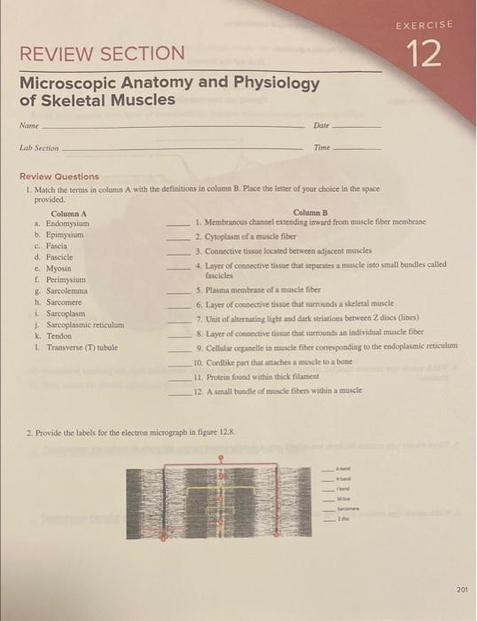 Solved EXERCISE 12 REVIEW SECTION Microscopic Anatomy and | Chegg.com