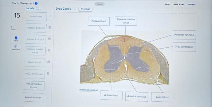 Solved Chapter 11 Assignment i SavedWhat is the function of | Chegg.com