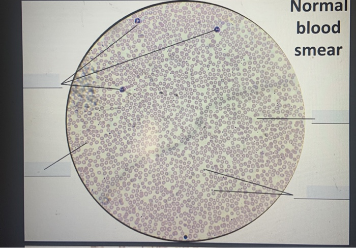 Solved Normal blood smear | Chegg.com
