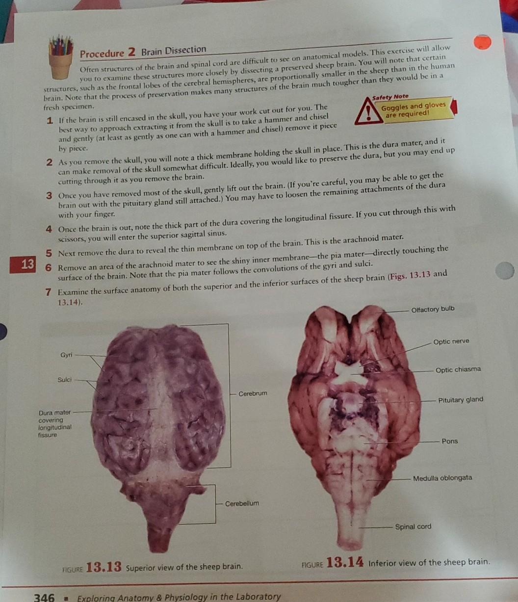 Solved A by piece. Procedure 2 Brain Dissection Often | Chegg.com