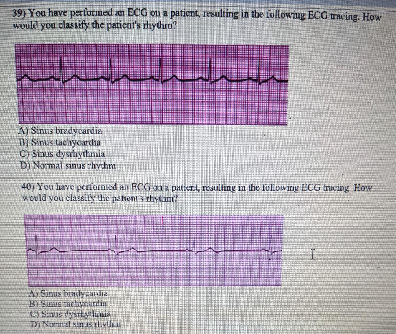 Solved 38) The part of the ECG tracing below that is circled | Chegg.com