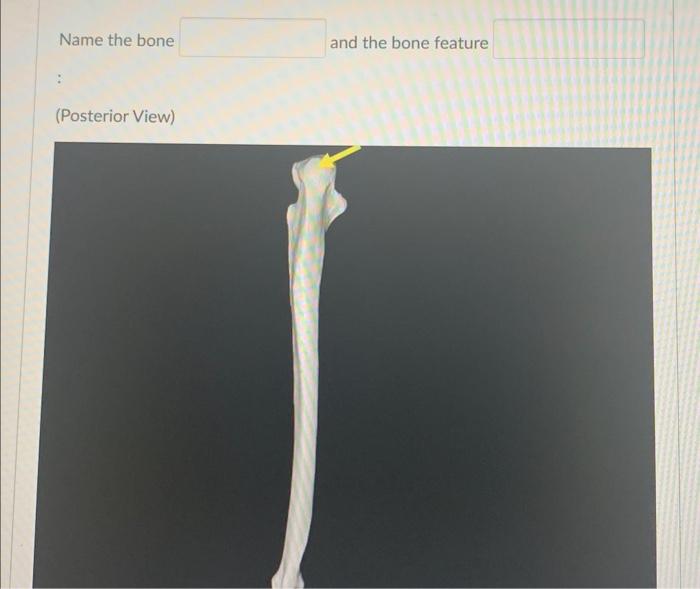 Solved Name the bone and the bone feature (Anterior | Chegg.com