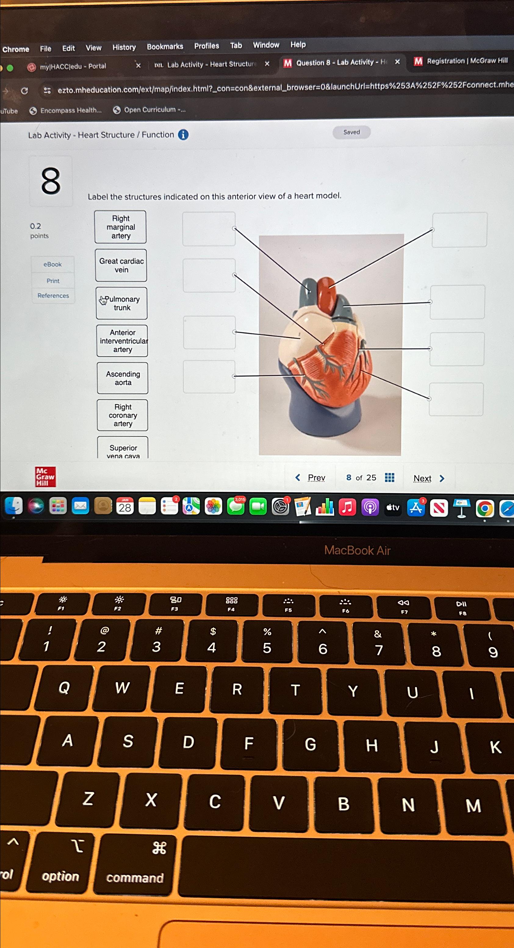 Solved Lab Activity - ﻿Heart Structure / ﻿Function | Chegg.com