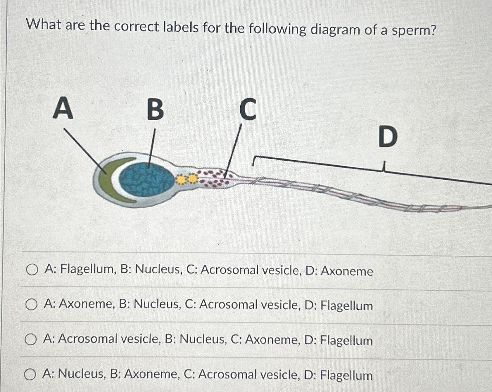 Solved What are the correct labels for the following diagram | Chegg.com