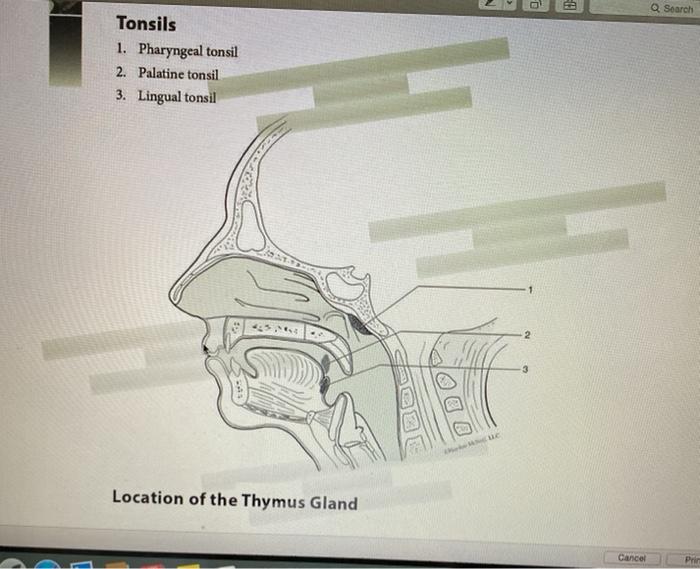Solved 1 3 3 Q Search Tonsils 1. Pharyngeal tonsil 2. | Chegg.com