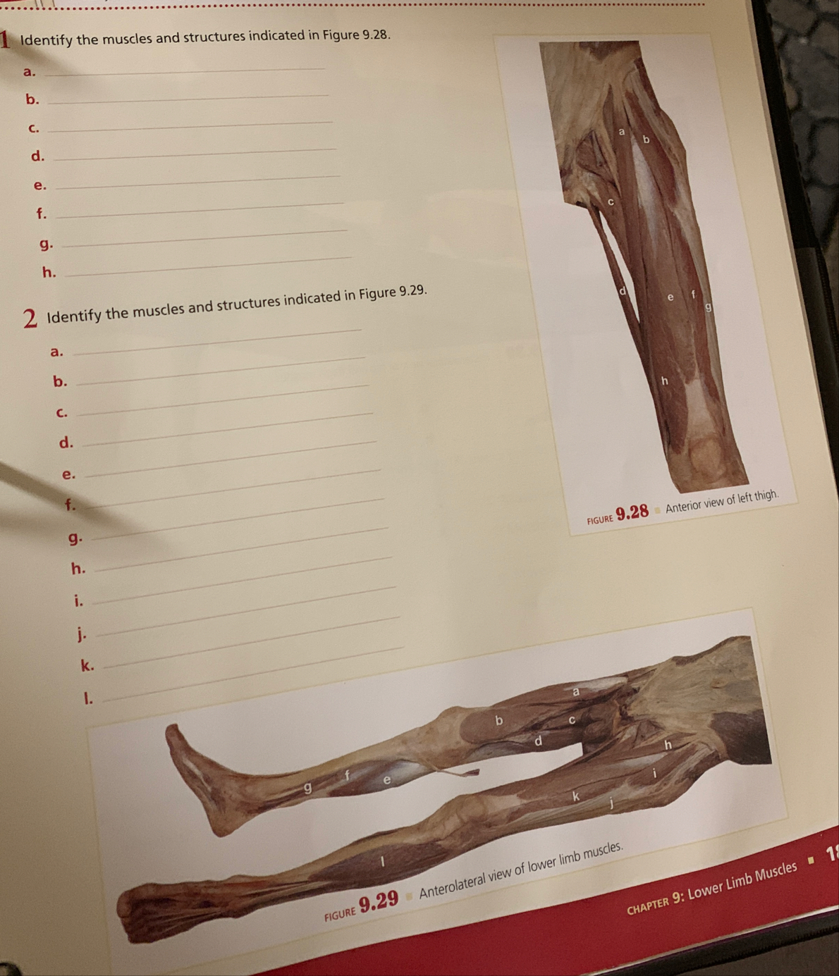 Solved Identify the muscles and structures indicated in | Chegg.com