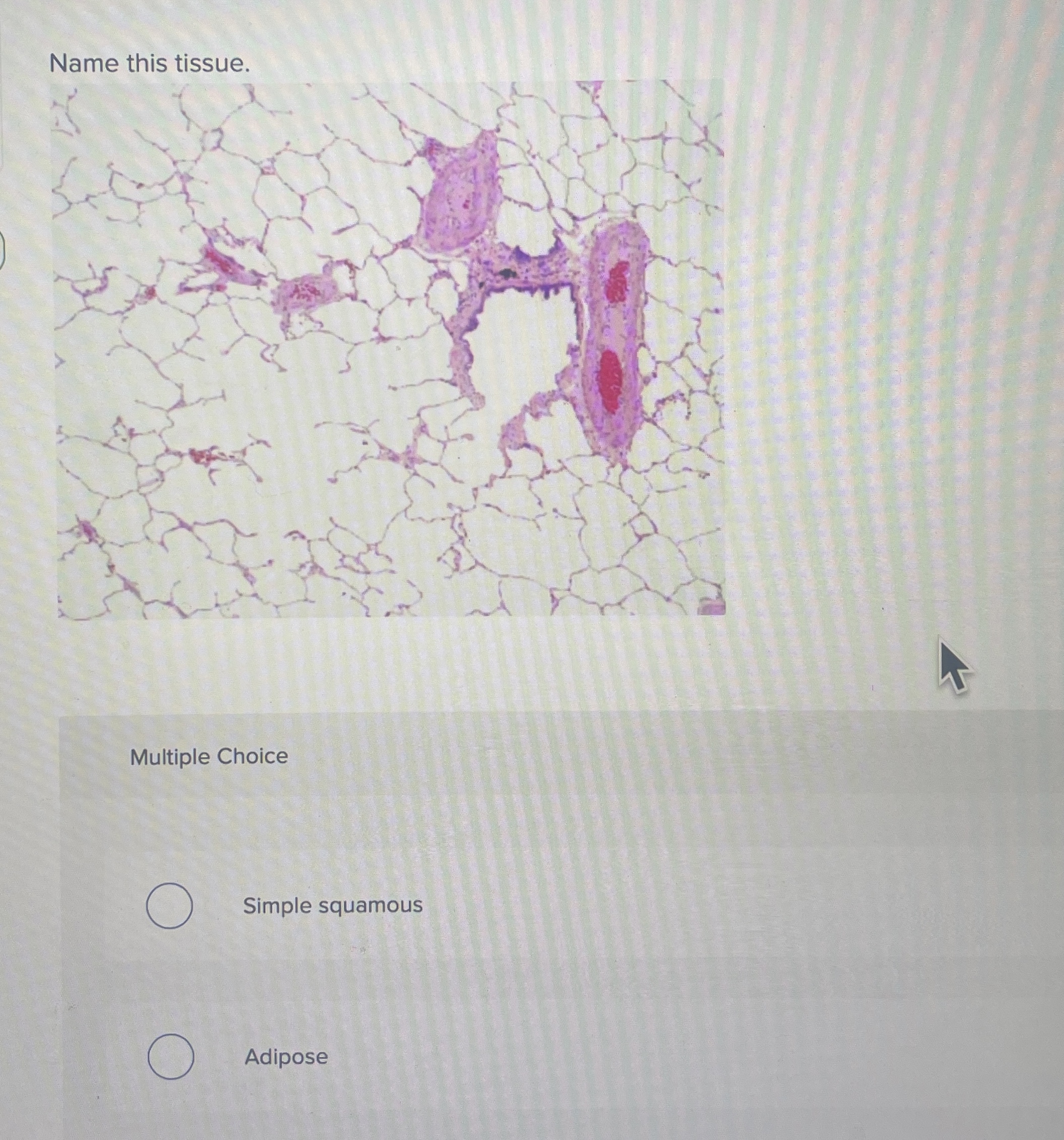 Solved Name this tissue.Multiple Choice ﻿Simple squamous | Chegg.com