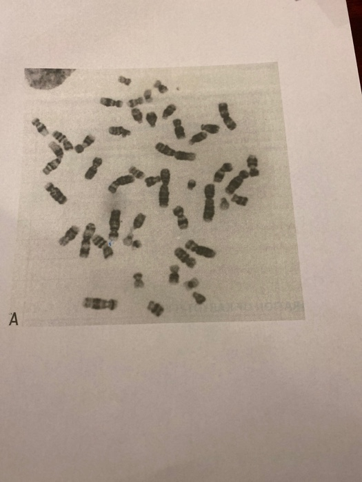 Solved Exercise 2: Karyotype analysis qvovys • In this part | Chegg.com