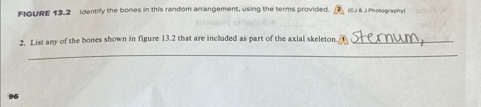 Solved FIGURE 13.2 ﻿Identify the bones in this random | Chegg.com