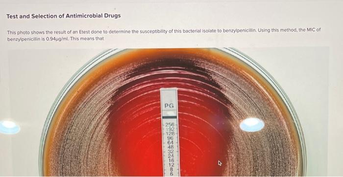 Solved Test and Selection of Antimicrobial Drugs This photo | Chegg.com