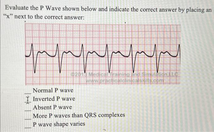 Evaluate the P Wave shown below and indicate the | Chegg.com