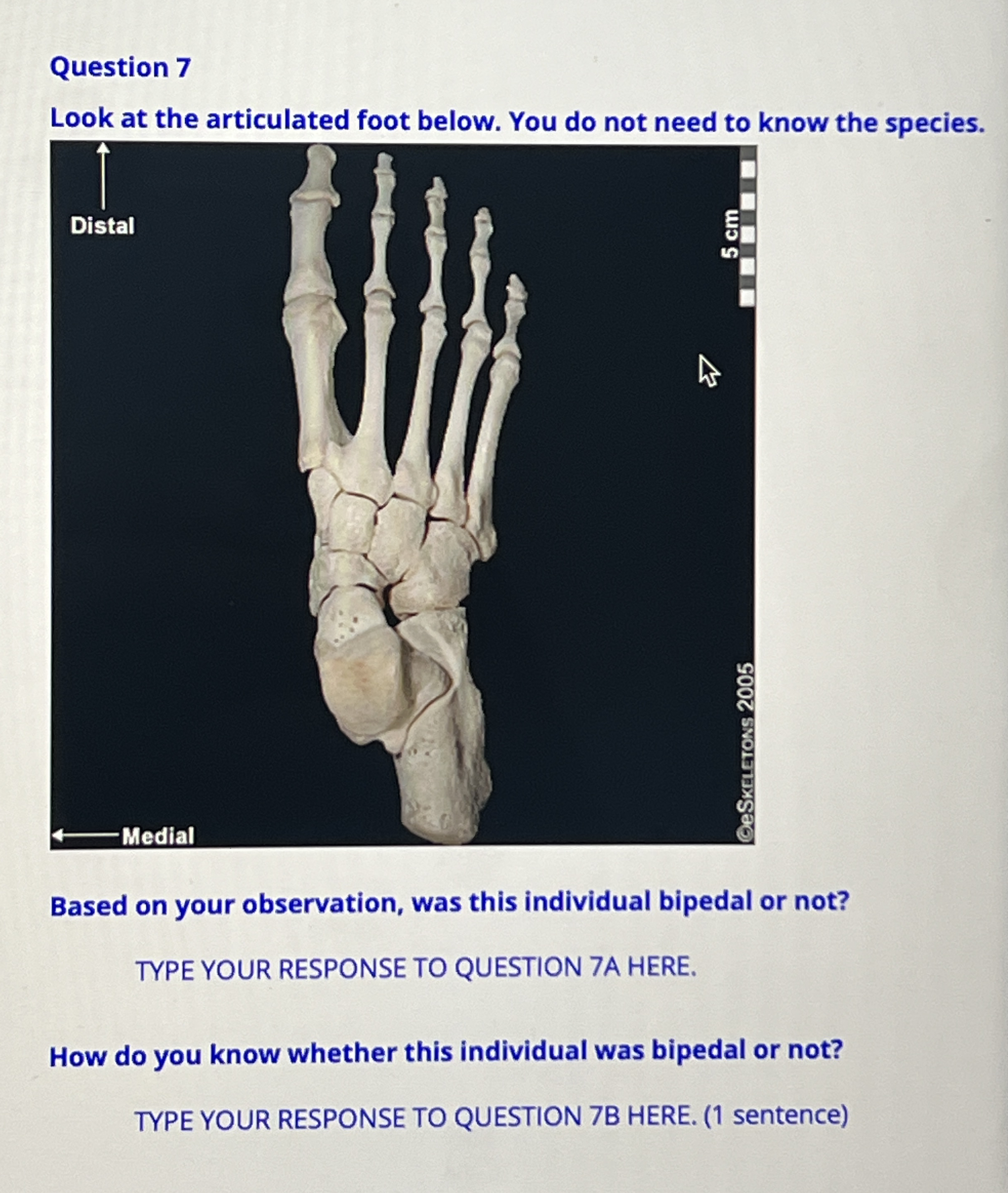 Question 7Look at the articulated foot below. You do | Chegg.com