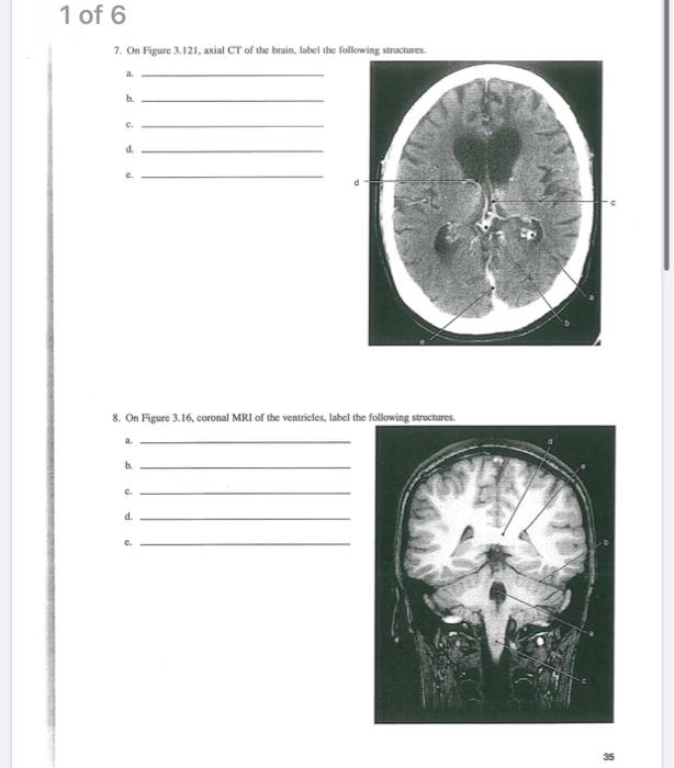 Solved 1 of 6 7. On Figure 3.121, axial CT of the brain, | Chegg.com