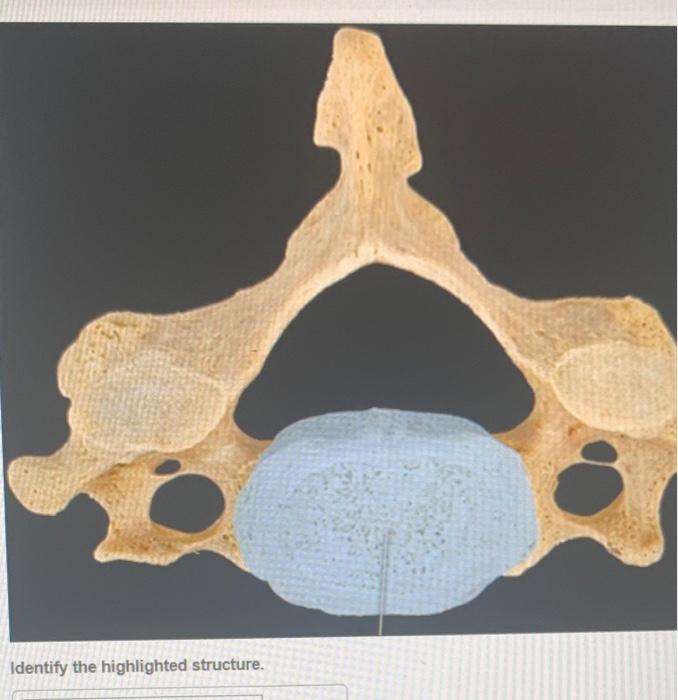 Solved Identify the highlighted structure. Identify the | Chegg.com