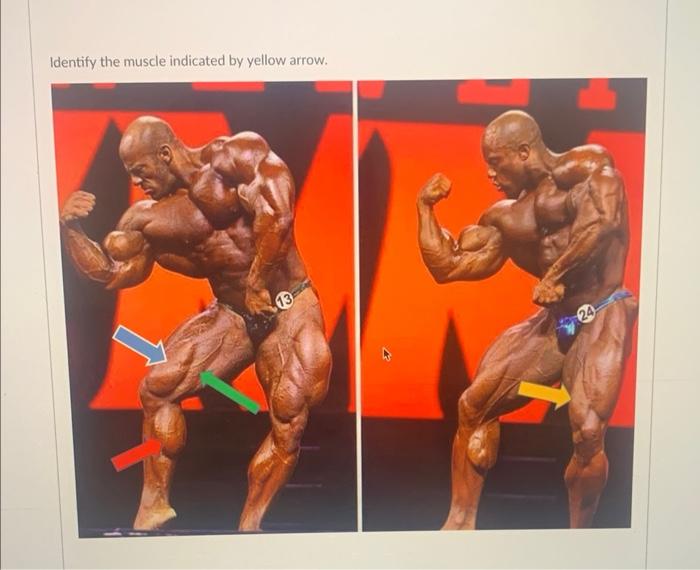 Solved Identify the muscle indicated by yellow | Chegg.com