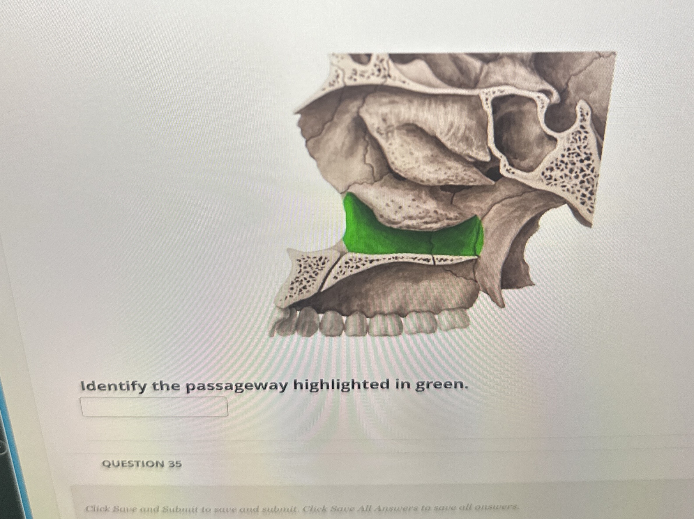 Solved Identify the passageway highlighted in green.QUESTION | Chegg.com