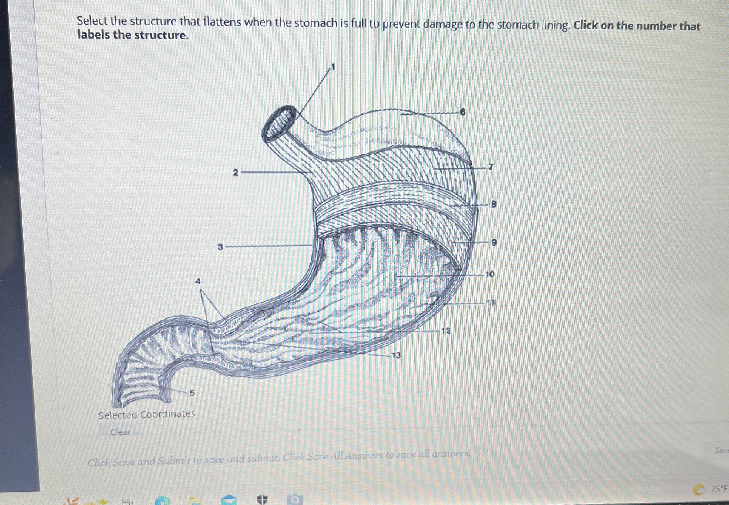 Solved Select the structure that flattens when the stomach | Chegg.com