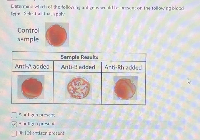 Solved Determine which of the following antigens would be | Chegg.com