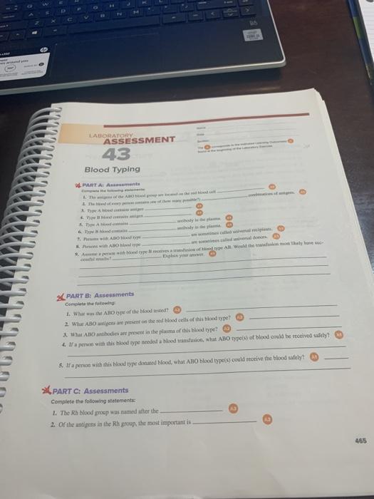 LABORATORY ASSESSMENT 43 Blood Typing PART AL Amante | Chegg.com
