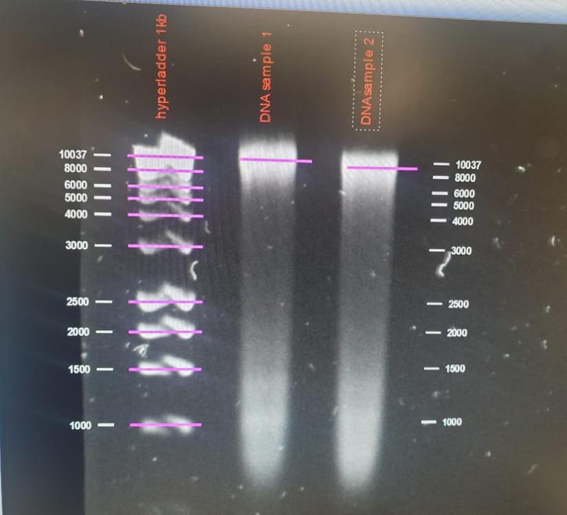 Solved hyperladder 1 kb DNA sample 1 DNA sample 2 10037 8000 | Chegg.com
