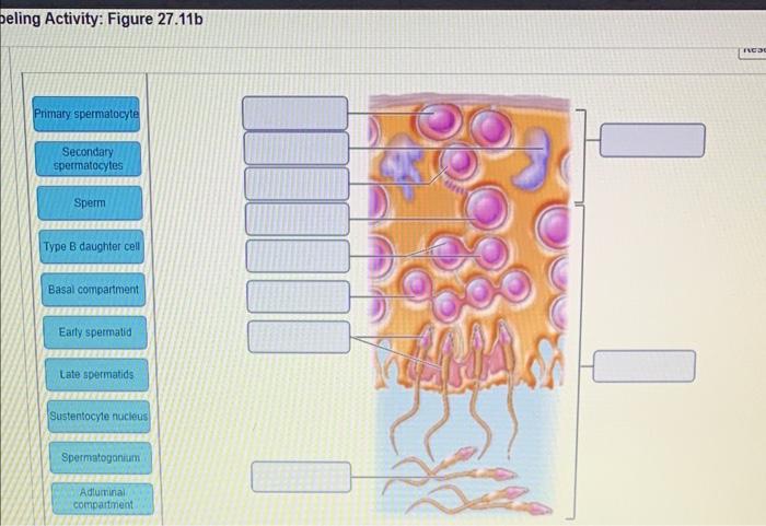 Deling Activity: Figure 27.11b | Chegg.com