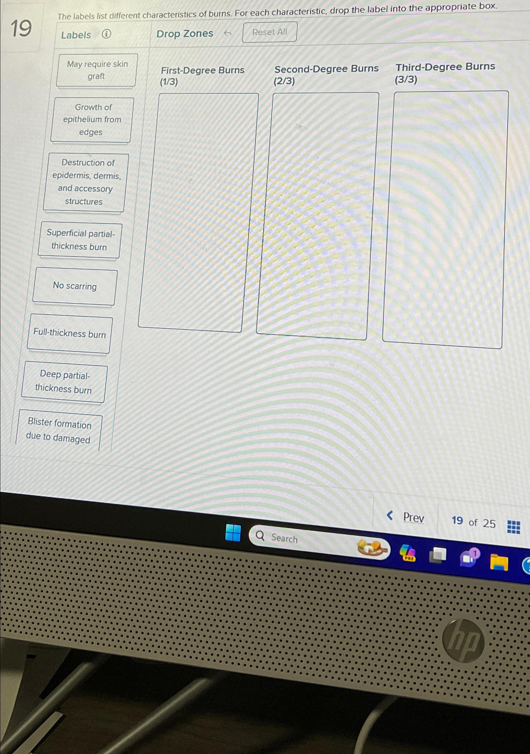 Solved 19The labels list different characteristics of burns. | Chegg.com
