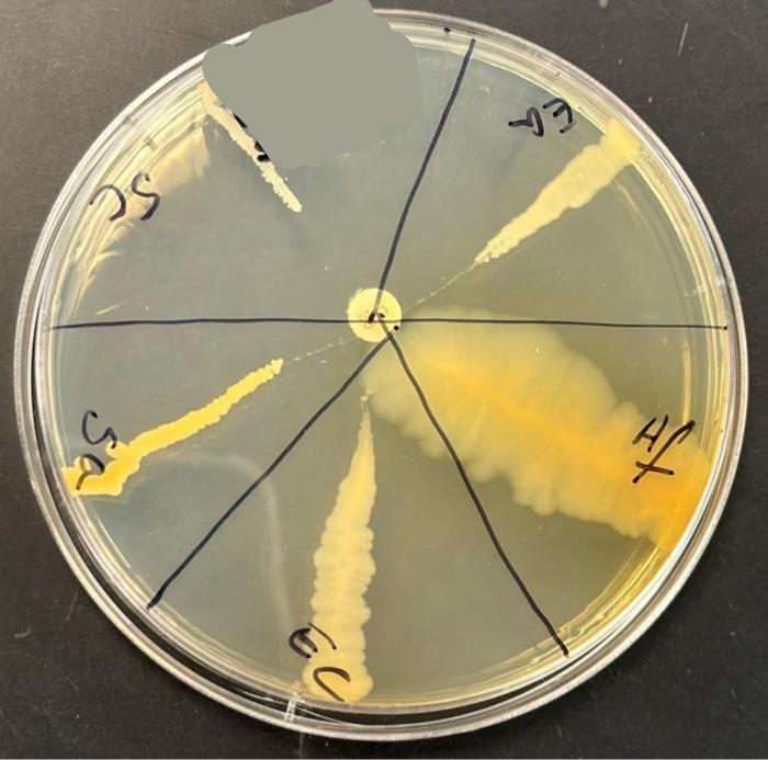 Antibiotic Lab - Summarize the two plates- Measure | Chegg.com