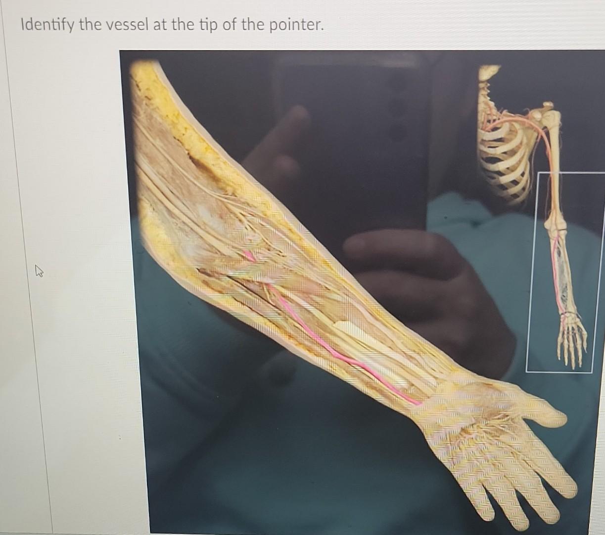Solved y the vessel at the tip of the pointer.Identify the | Chegg.com