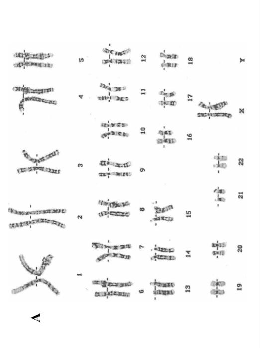 Solved Karyotype Lab Chromosome structure and chromosome | Chegg.com