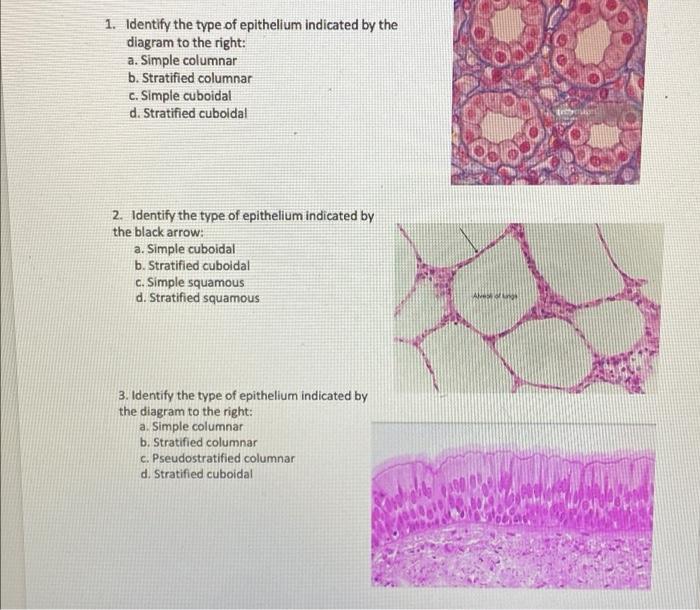 Solved 1. Identify the type of epithelium indicated by the | Chegg.com