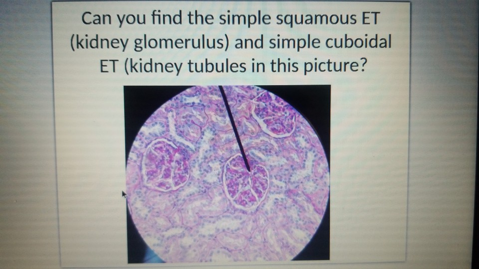 Solved Can you find the simple squamous ET (kidney | Chegg.com