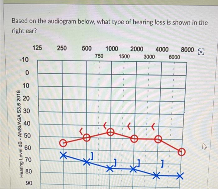 Solved Based on the audiogram below, what type of hearing | Chegg.com