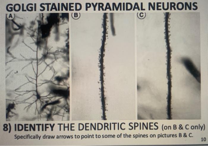 Solved GOLGI STAINED PYRAMIDAL NEURONS A (B) 8) IDENTIFY THE | Chegg.com