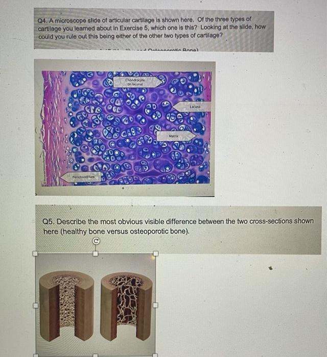 Solved Q4. A microscope slide of articular cartilage is | Chegg.com