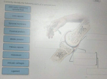 Solved Correctly identify the following parts of a synovial | Chegg.com