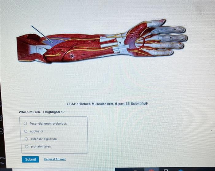 Solved LT-M11:Deluxe Muscular Arm, 6-part,3B Scientific(t) | Chegg.com